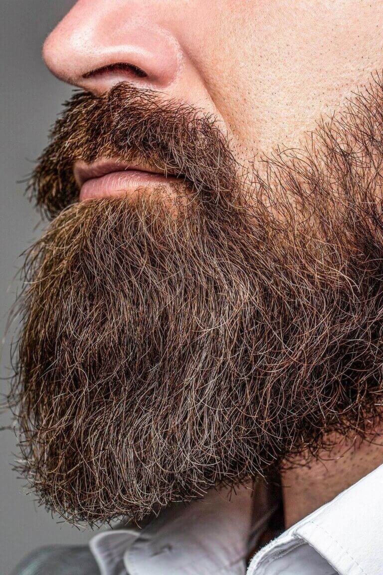 Beard Transplant - Beard Transplant Turkey - MedPrime Clinic